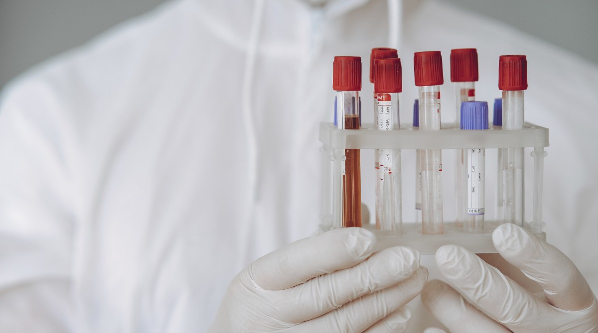 The smallest RNAs identify the most important body fluids in forensics ...